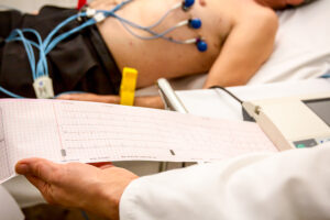 Signs That You Might Need an EKG at CareWell Urgent Care